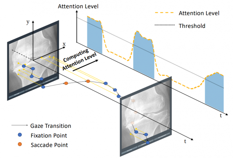 Follow My Eye: Using Gaze to Supervise Computer-Aided Diagnosis | Qian ...